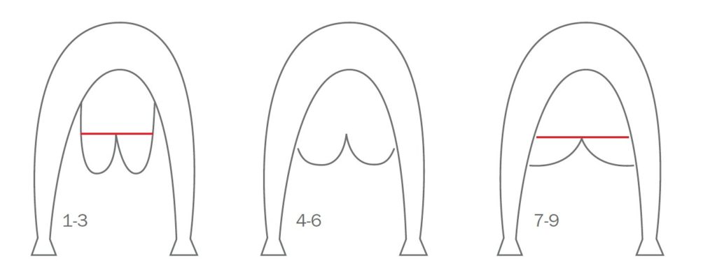 5 factors you need to master to improve Udder conformation